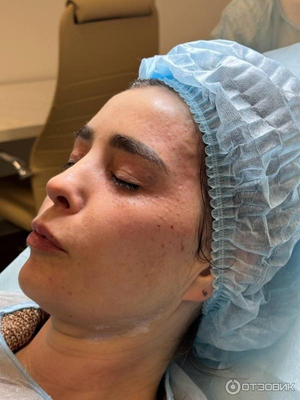 Отзыв о Коллагеновый материал COLLOST micro | опыт от прохождения курса