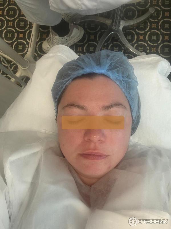 Отзыв о Косметическая процедура Pollogen GeneO+ | Поддерживает здоровье ...