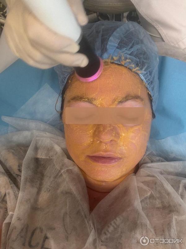 Отзыв о Косметическая процедура Pollogen GeneO+ | Поддерживает здоровье ...